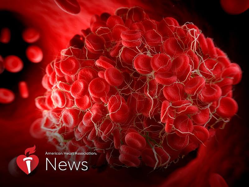 AHA News: Blood Clot Risk Remains Elevated Nearly a Year After COVID-19 ...