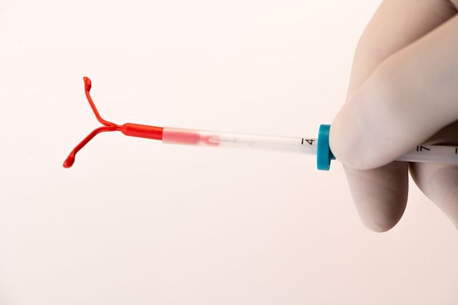 IUD Placement at Two to Four Weeks Postpartum Noninferior - Consumer ...